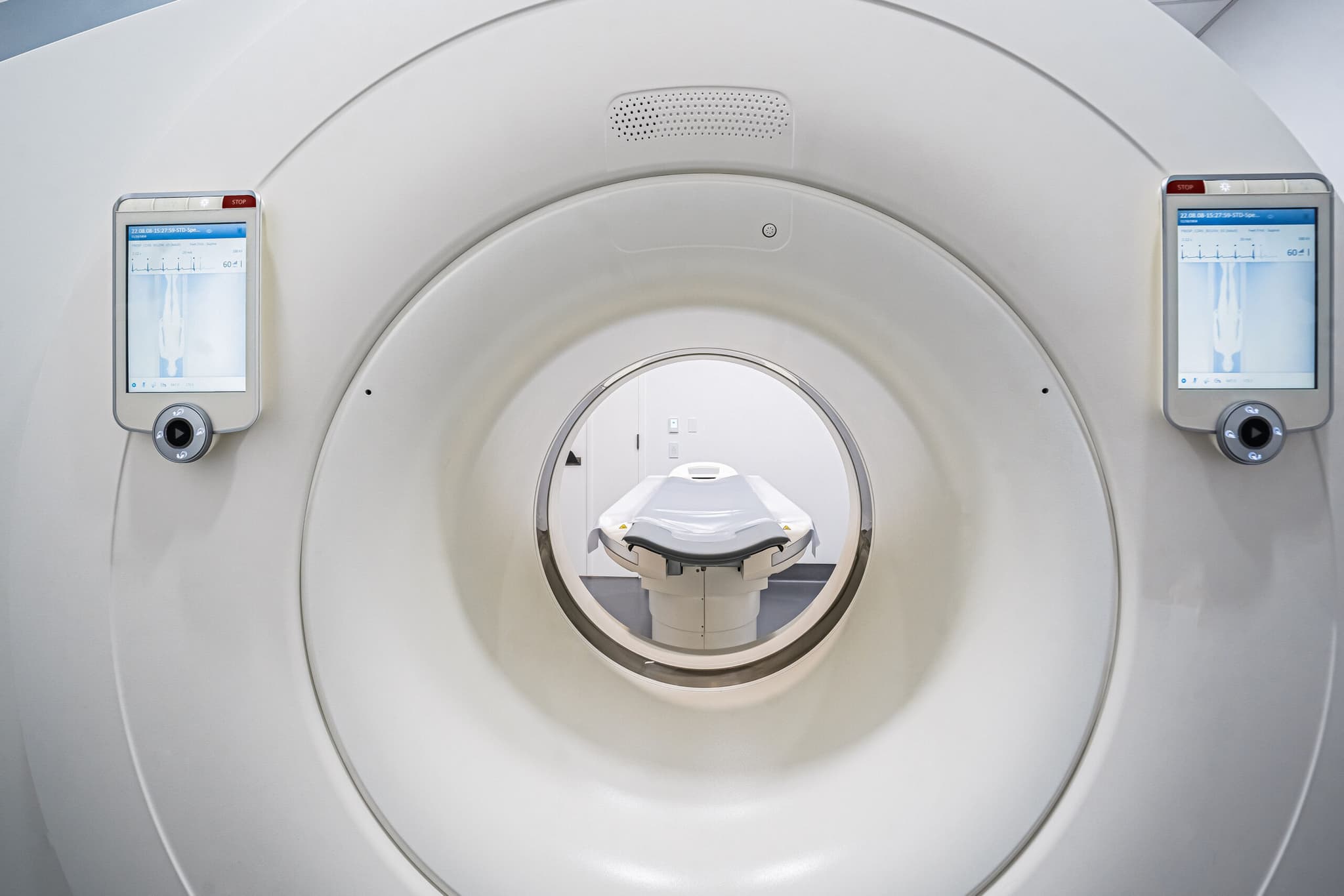 Sorin Heart Scan